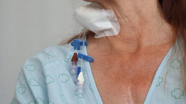 Tracheostomy Collar: Supporting Respiratory Care and Comfort